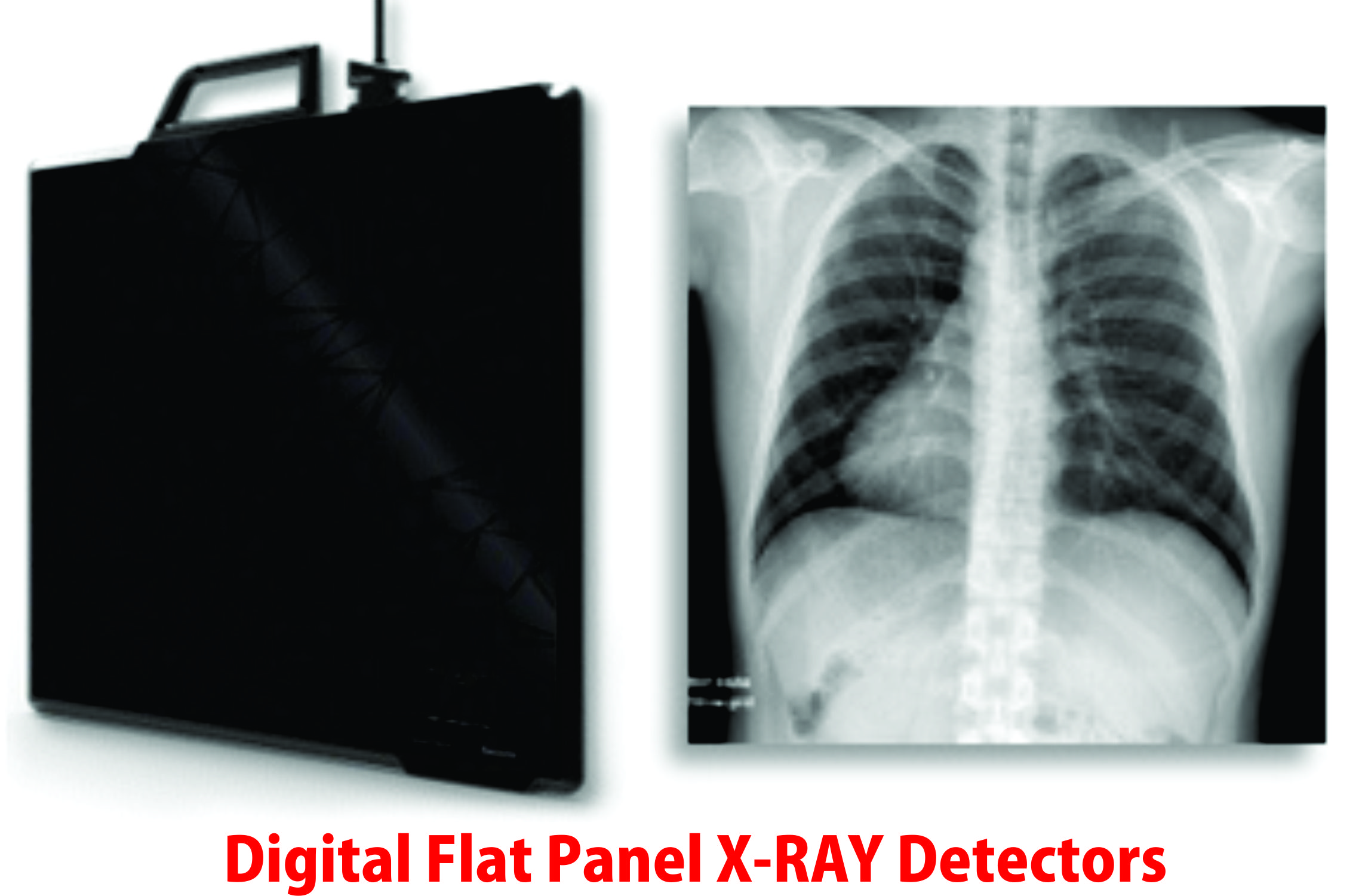 AMC Miliki Digital Flat Panel X-Ray - AMC Balikpapan